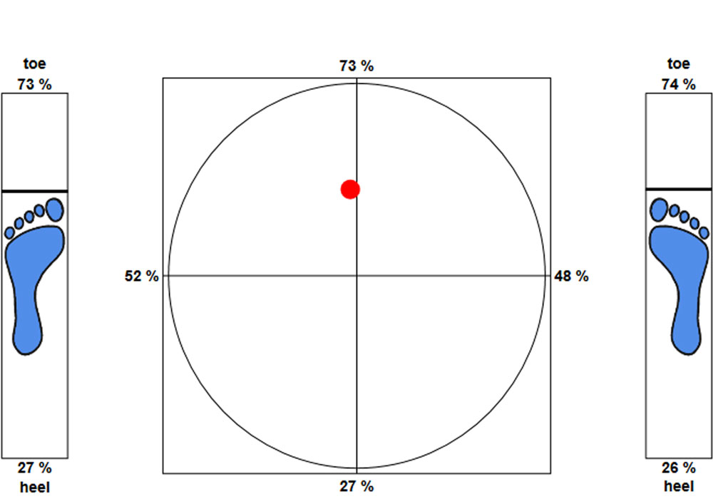 SAM BalanceLab Features – Science & Motion Sports